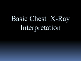 chest examination.pptx.pdf