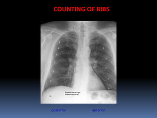 chest examination.pptx.pdf