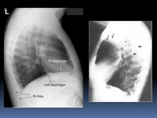 chest examination.pptx.pdf