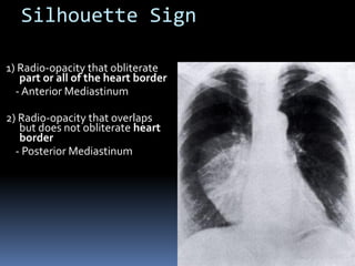 chest examination.pptx.pdf