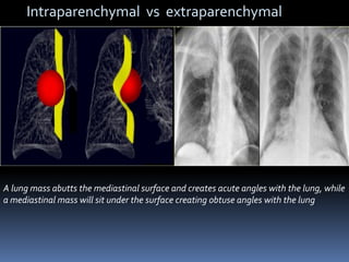 chest examination.pptx.pdf