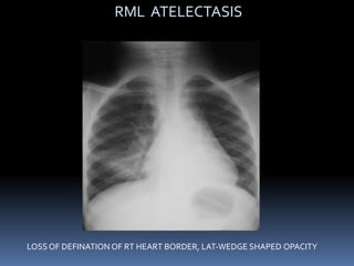 chest examination.pptx.pdf