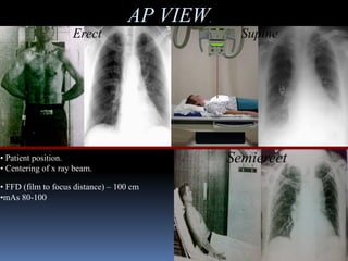 chest examination.pptx.pdf