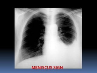 chest examination.pptx.pdf