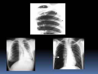 chest examination.pptx.pdf