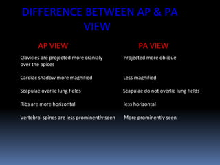 chest examination.pptx.pdf
