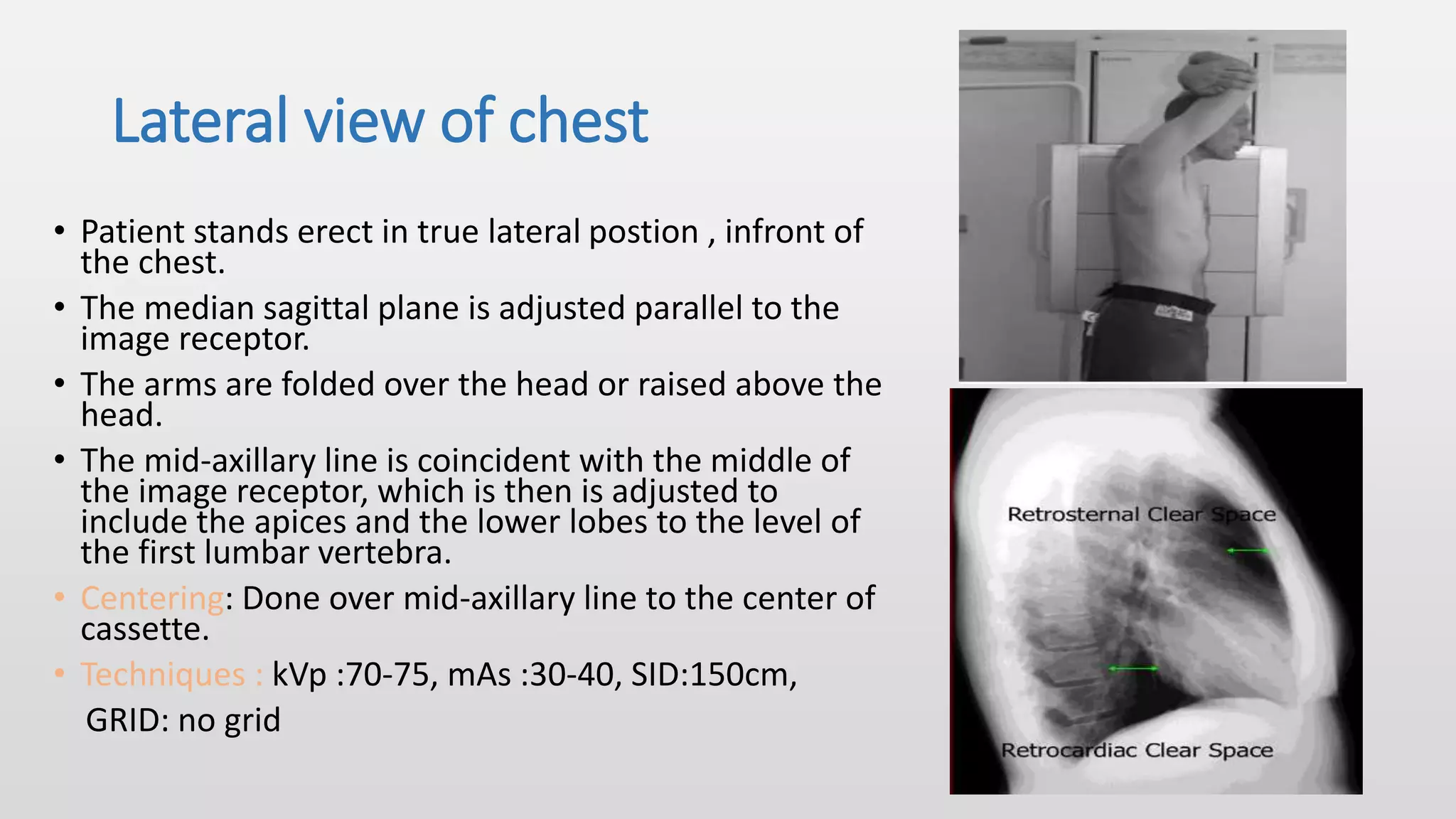 chest.pptx