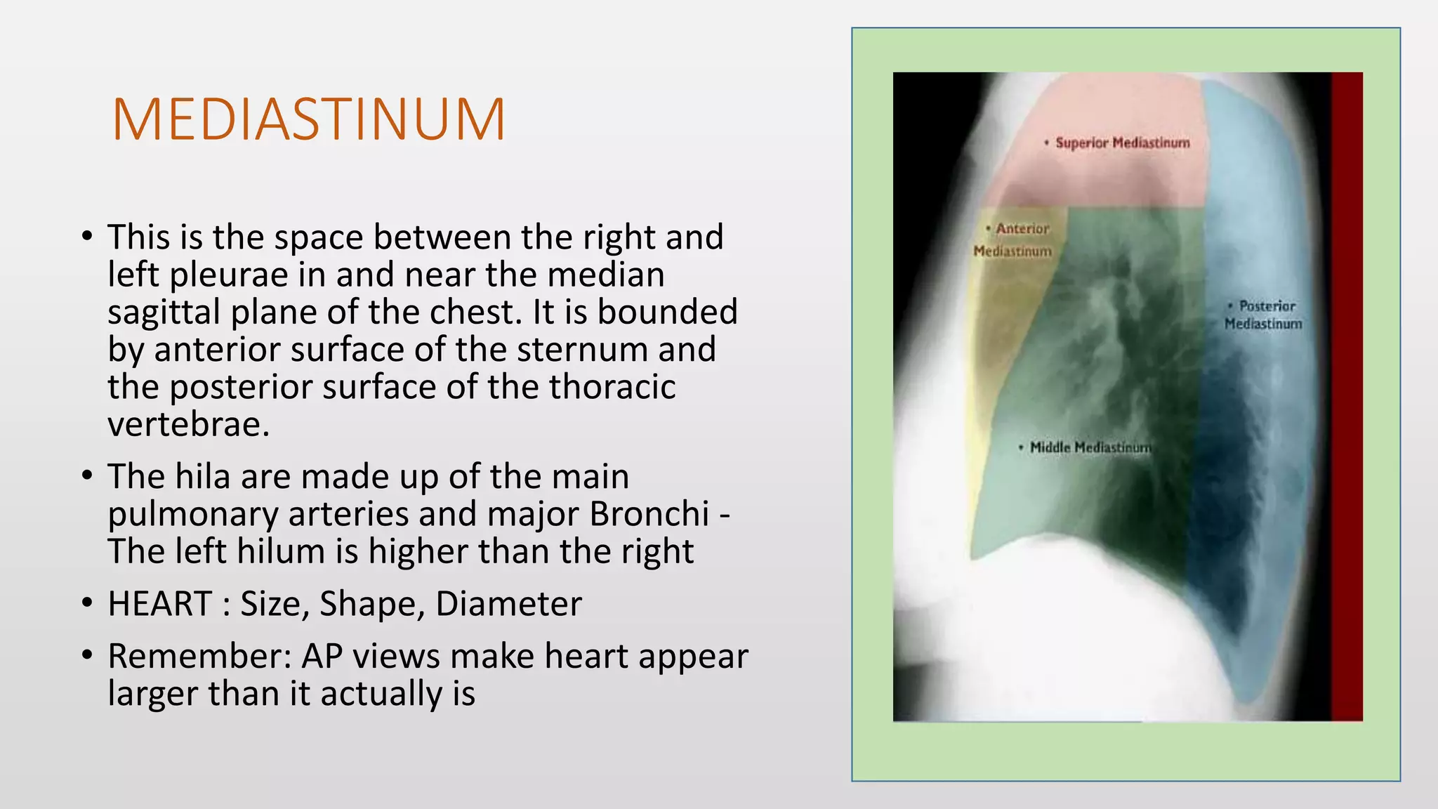chest.pptx