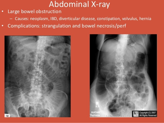 Chest and Abdomen Radiology