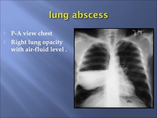Chest Imaging for Medical Students | PPT
