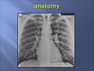 Chest Imaging for Medical Students | PPT