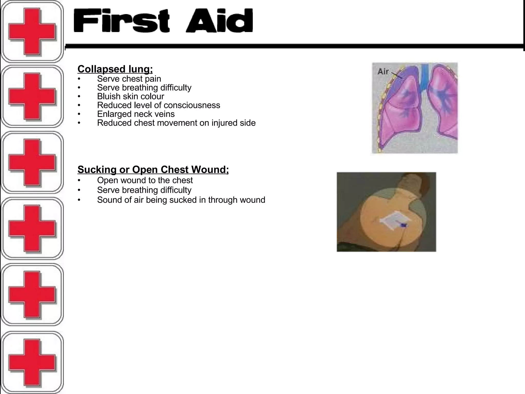 Chest Injuries | PPT