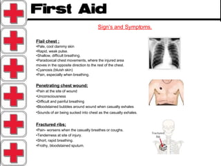 Chest Injuries | PPT