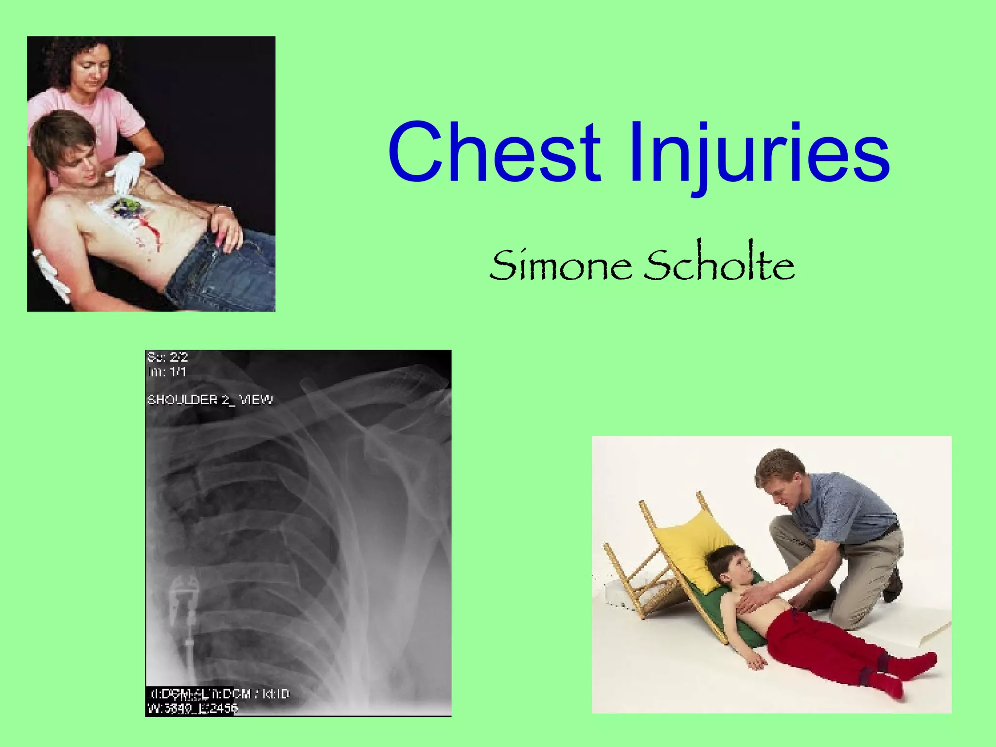 Chest Injuries | PPT