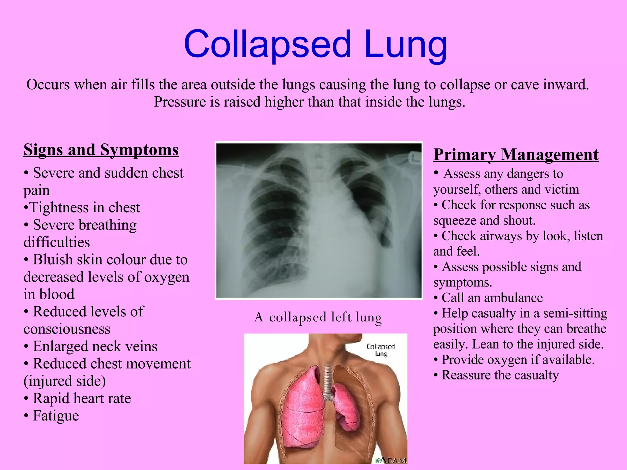 Chest Injuries | PPT