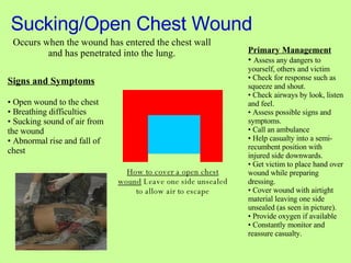 Chest Injuries | PPT