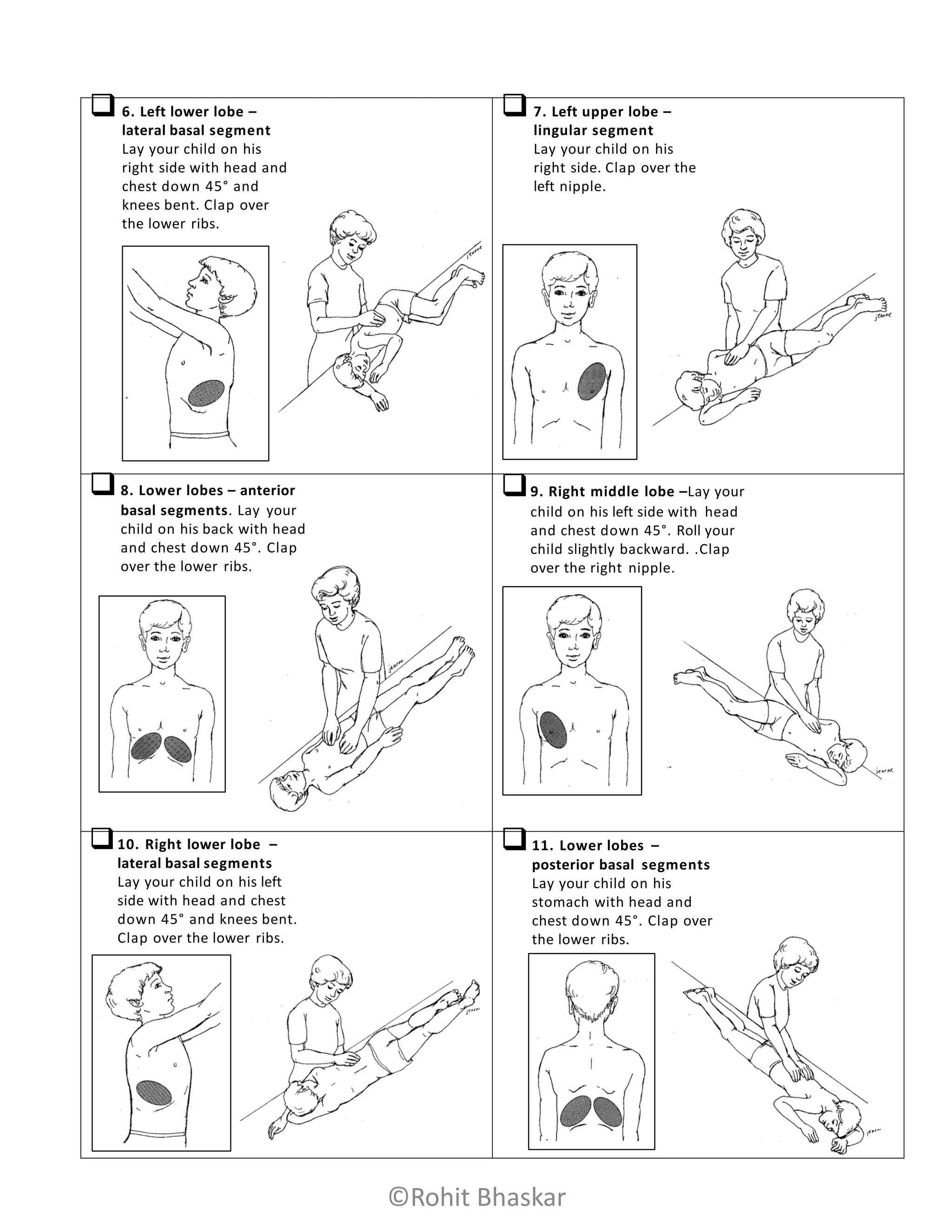 Chest Physiotherapy Procedure & Techniques - Dr Rohit Bhaskar | PDF