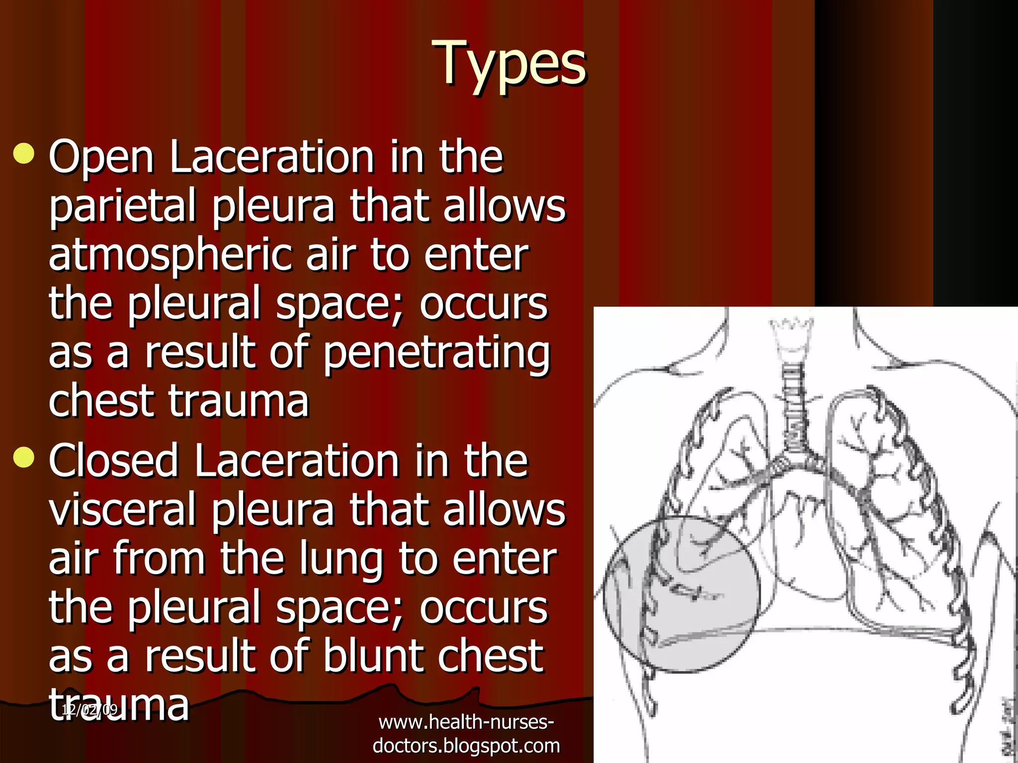 Chest Trauma | PPT