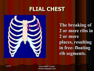 Chest Trauma | PPT