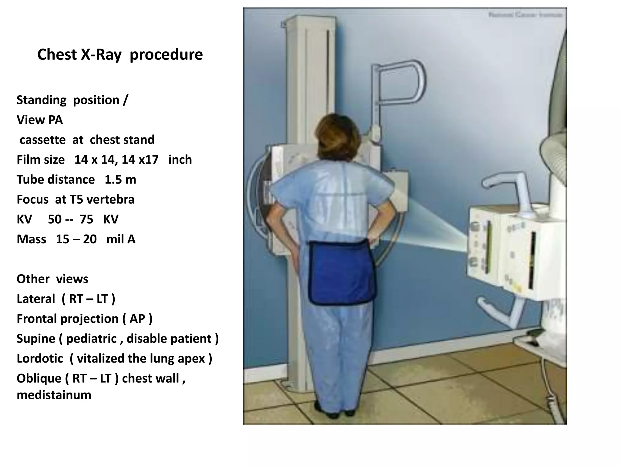 Chest x - ray | PPTX | Lung and Respiratory Health | Diseases and ...