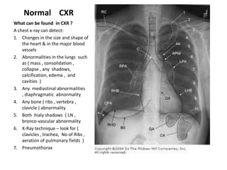 Chest x - ray | PPTX | Lung and Respiratory Health | Diseases and ...