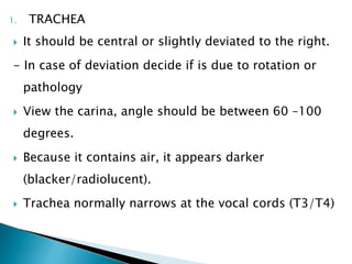 Chest x-ray.zp162335 | PPT