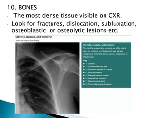 chest-x-ray.zp162335.ppt