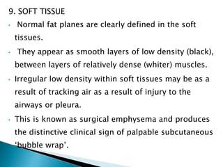 chest-x-ray.zp162335.ppt