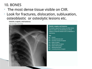 chest-x-ray is a fundamental topic for medical students | PPT