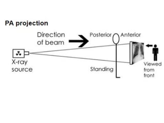 Chest-X-ray-Quality.presentations for med | PPT