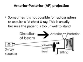 Chest-X-ray-Quality.presentations for med | PPT