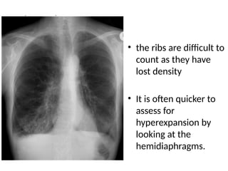 Chest-X-ray-Quality.presentations for med | PPTX