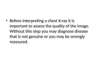 Chest-X-ray-Quality.presentations for med | PPTX