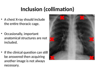Chest-X-ray-Quality.presentations for med | PPT
