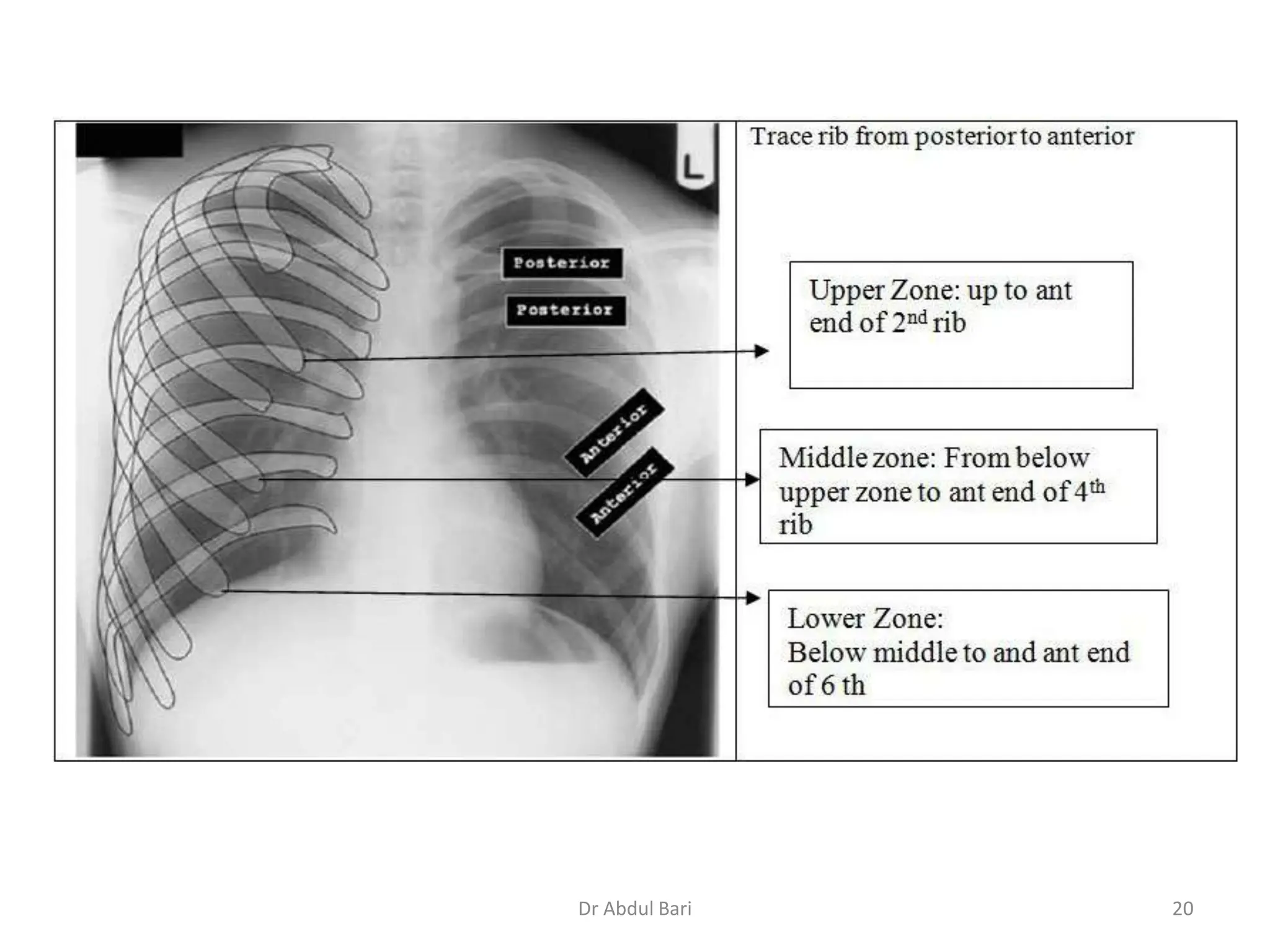 chest-x-ray-teaching-tutorial.pptx