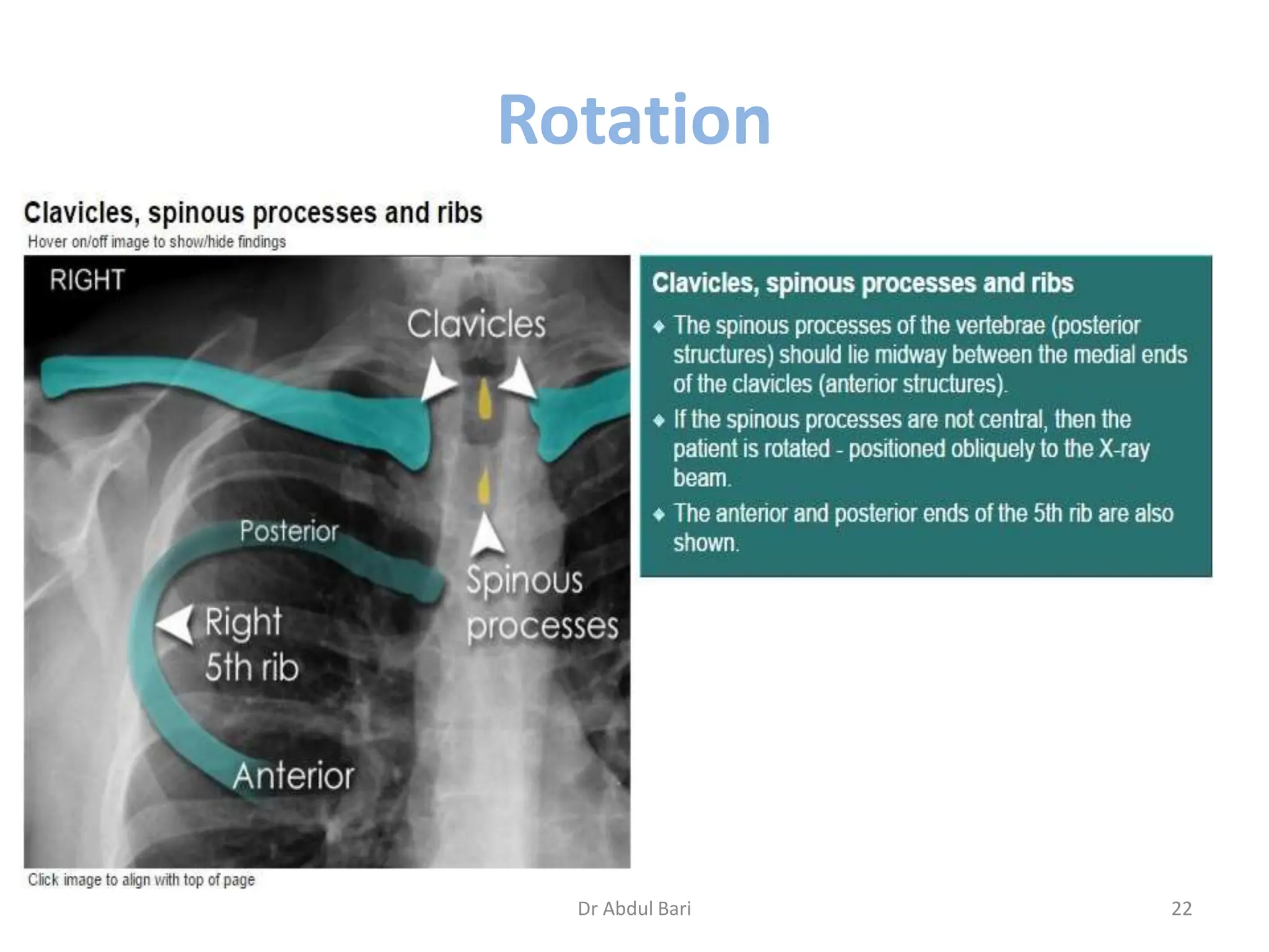 chest-x-ray-teaching-tutorial.pptx