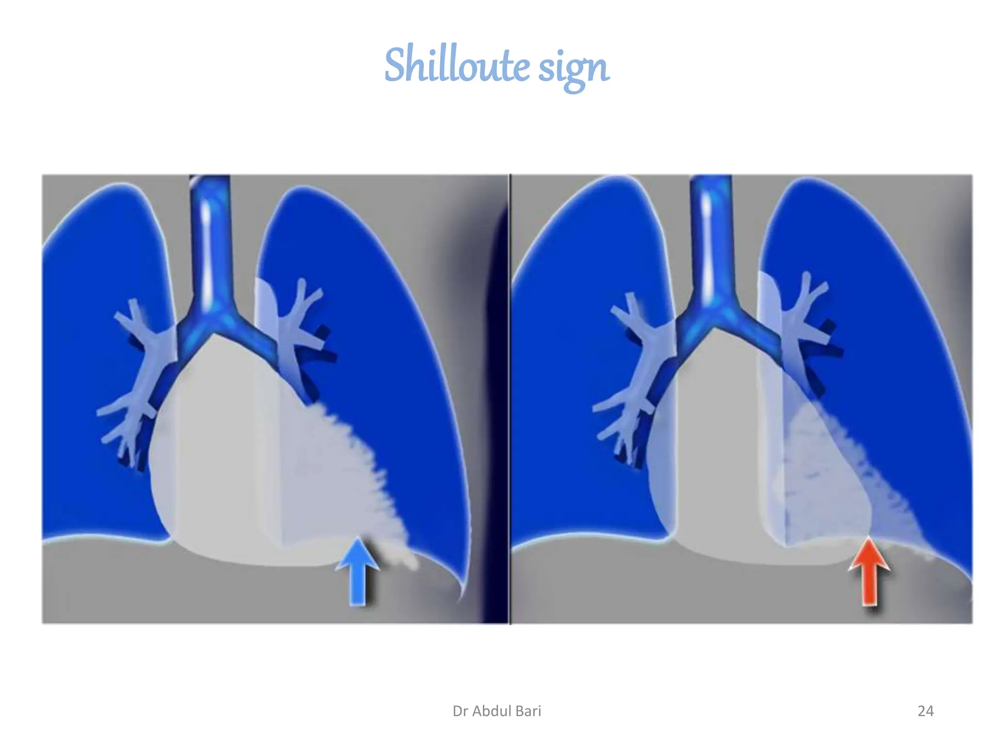 chest-x-ray-teaching-tutorial.pptx