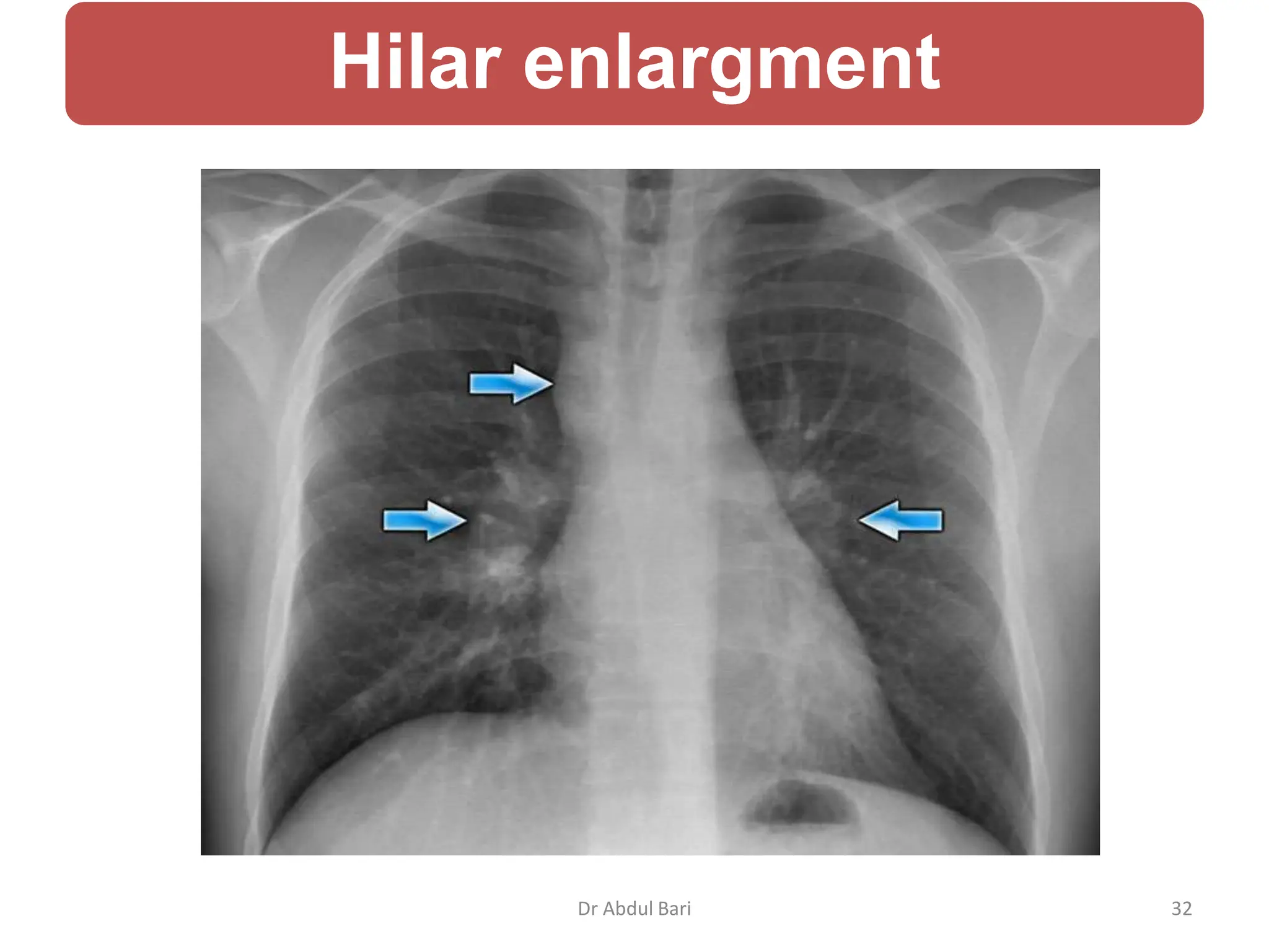 chest-x-ray-teaching-tutorial.pptx