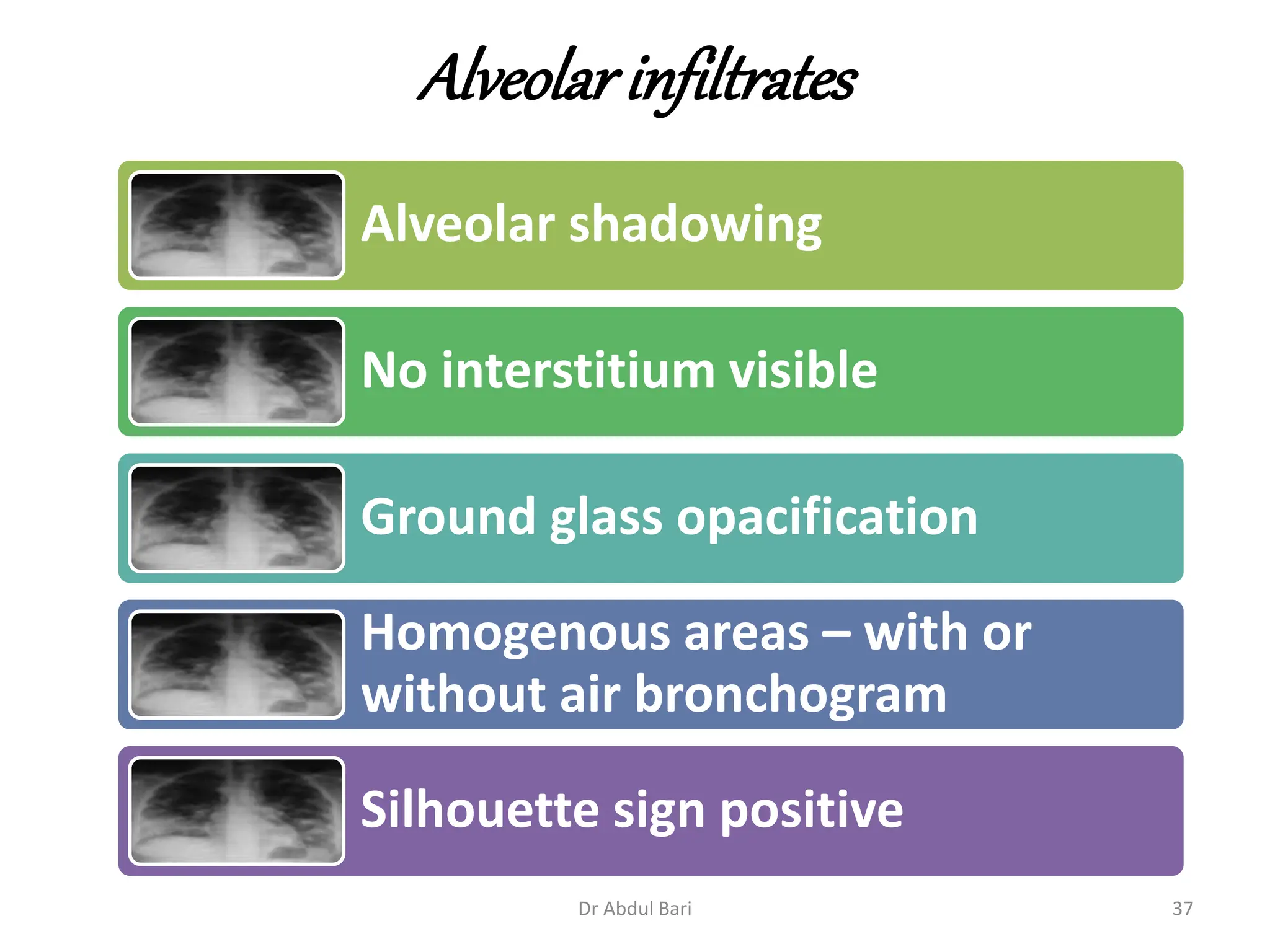 chest-x-ray-teaching-tutorial.pptx