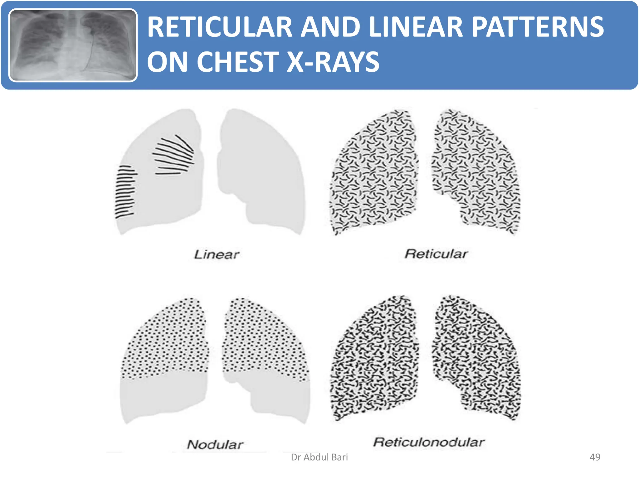 chest-x-ray-teaching-tutorial.pptx