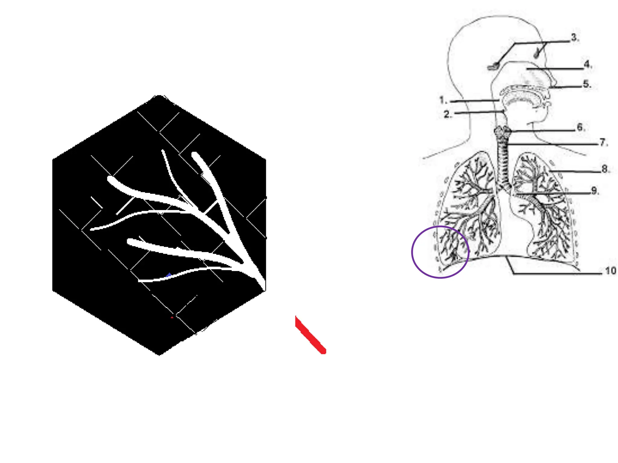 chest-x-ray-teaching-tutorial.pptx