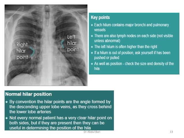 chest-x-ray-teaching-tutorial.pptx