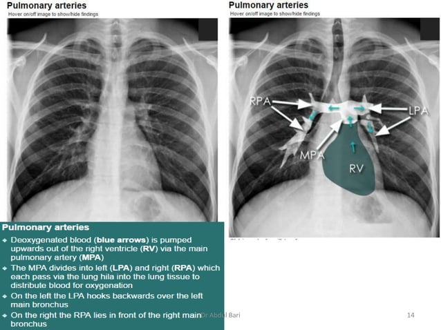 chest-x-ray-teaching-tutorial.pptx