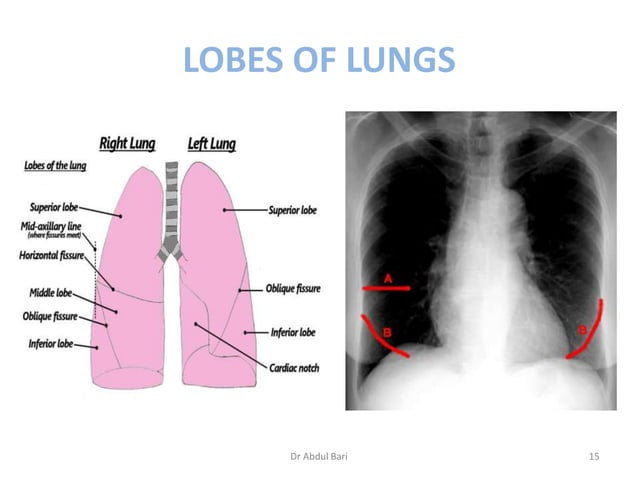 chest-x-ray-teaching-tutorial.pptx