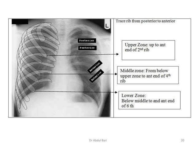 chest-x-ray-teaching-tutorial.pptx
