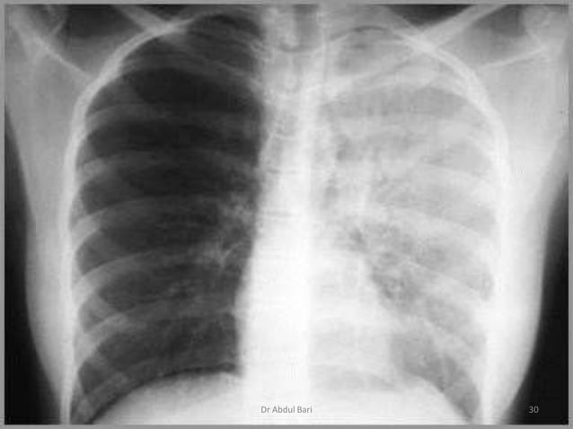 chest-x-ray-teaching-tutorial.pptx