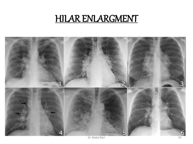 chest-x-ray-teaching-tutorial.pptx