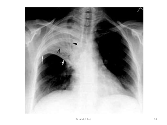 chest-x-ray-teaching-tutorial.pptx