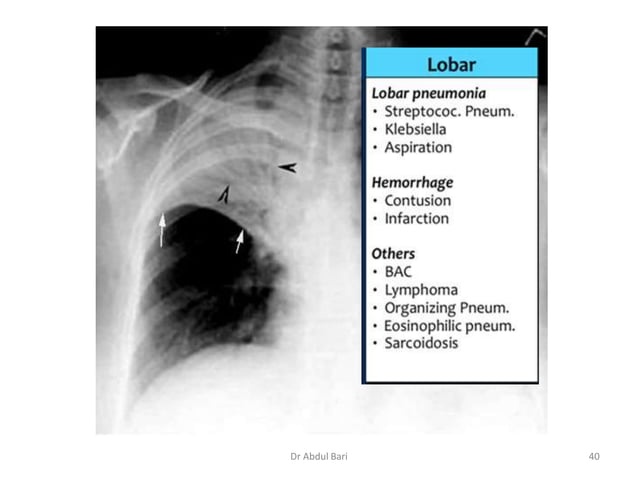 chest-x-ray-teaching-tutorial.pptx