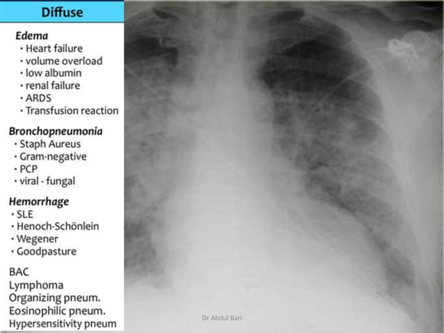 chest-x-ray-teaching-tutorial.pptx